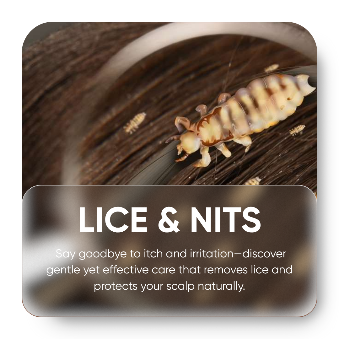 Lice and Nits Treatment | Natural Solutions by Botanical Luxuriate
